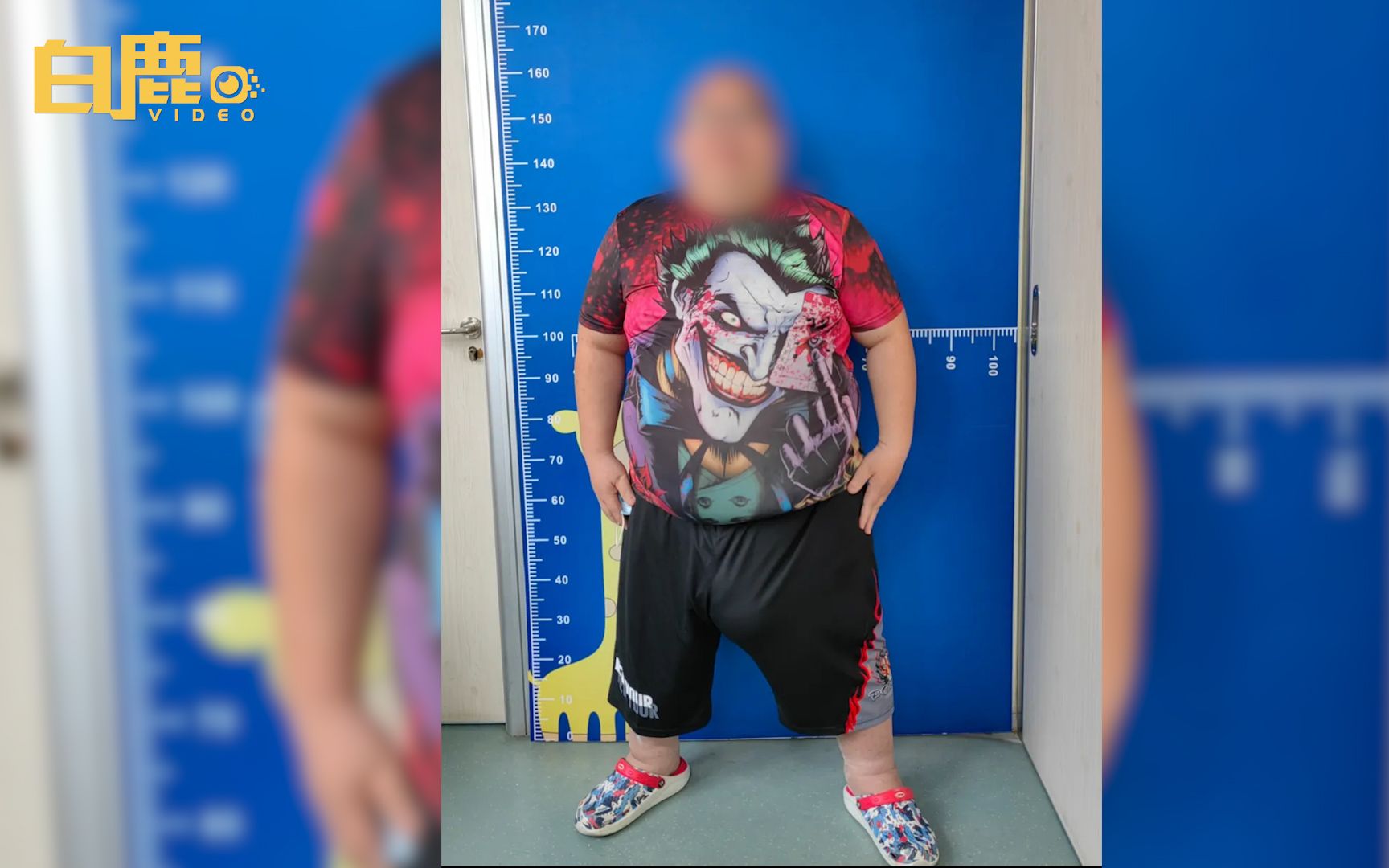 再胖下去健康堪忧!男子30年喝下近6吨可乐胖到305斤