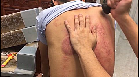 BG-05 BG05 拔罐机 真空负压机 电动拔罐 电动刮痧 电动滑罐 走罐