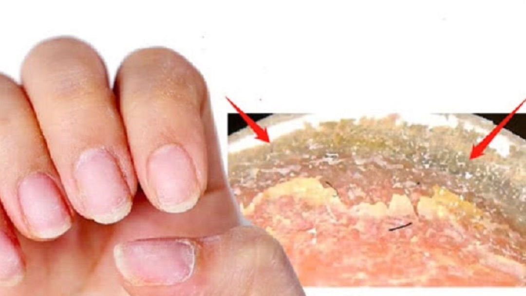显微镜下的手指甲长啥样?放大100倍,你还敢乱啃吗?