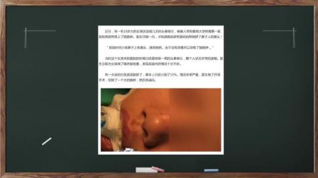 10岁女孩因挤黑头患上脑脓肿, 妈妈后悔不已!