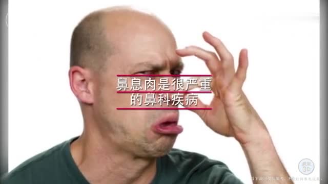 看着揪心!鼻息肉切除手术的3D演示