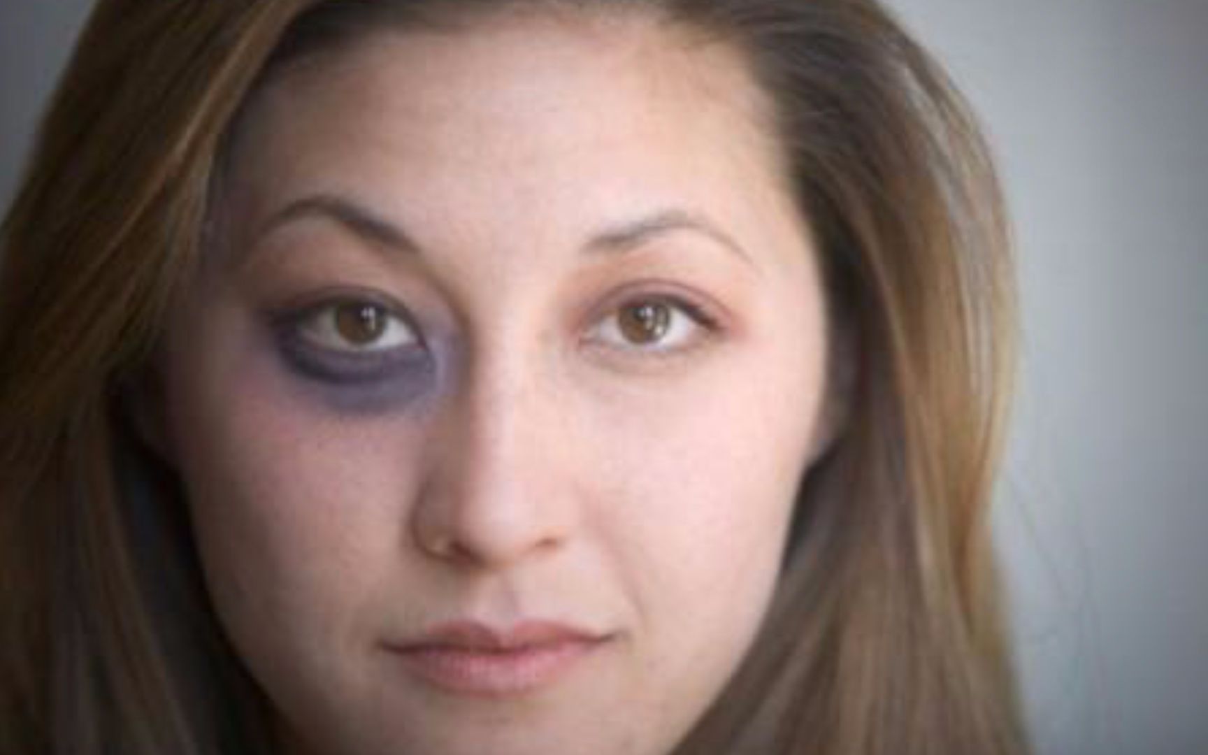 维生素E真是个好东西,祛痘印、淡斑,可惜很多女人都不会用