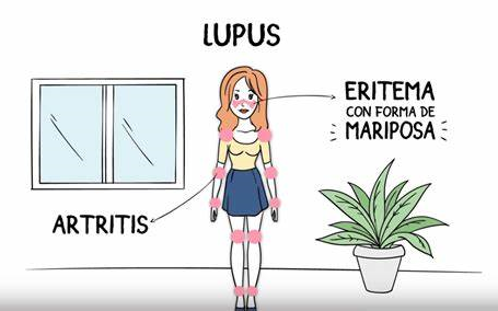 狼疮小鼠模型的建立A Mouse Model to Understand Lupus