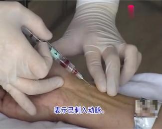 动脉穿刺术临床医师技能操作