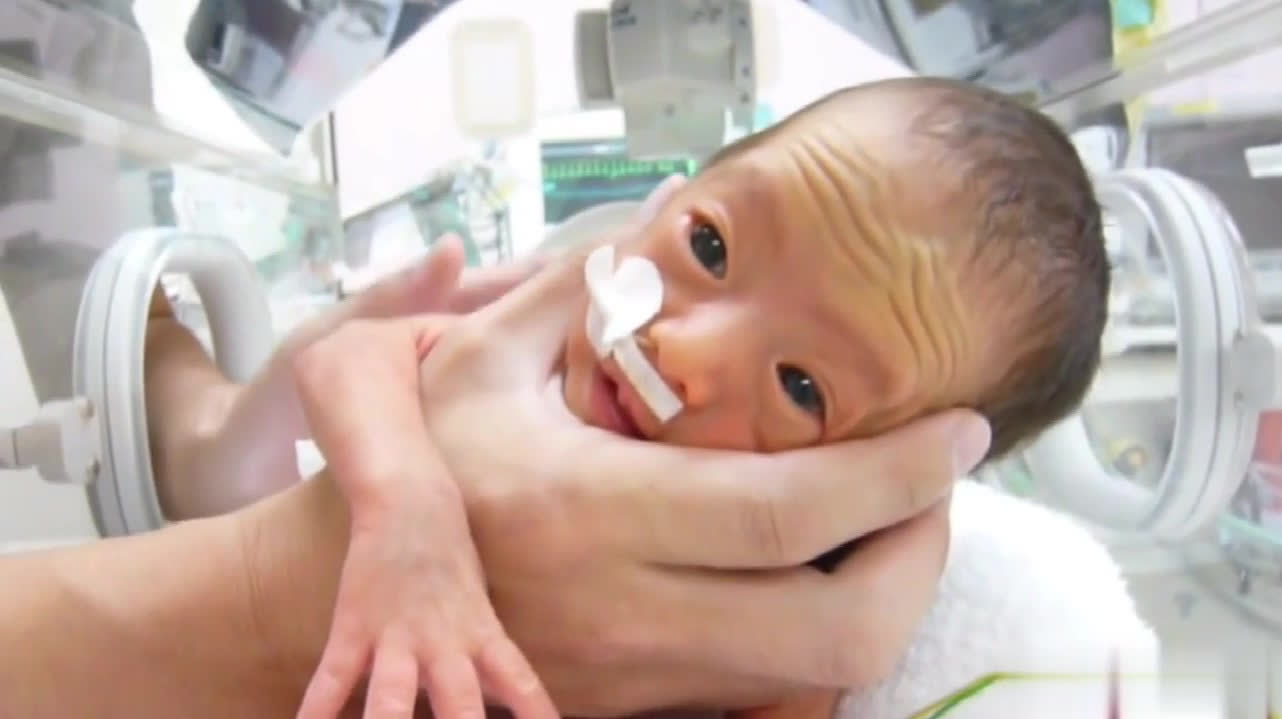 医生给刚出生的早产儿宝宝喂奶,宝宝脆弱的身体,没有谁不心疼!