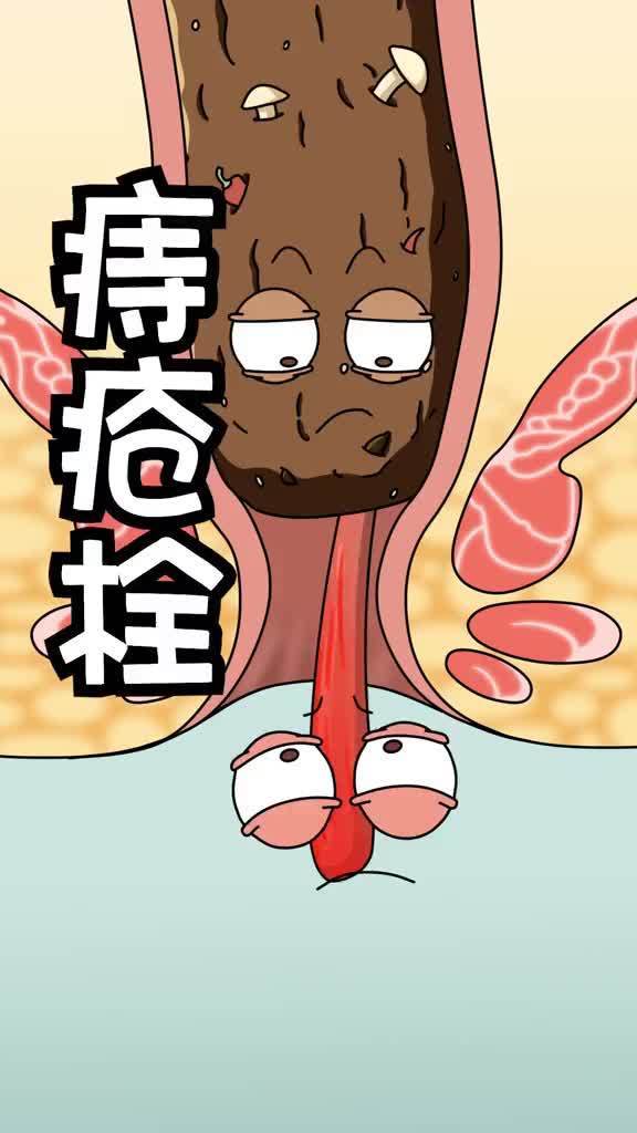 这就是痔疮栓啊!