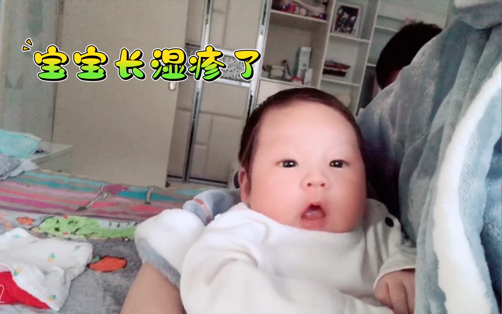 ...湿疹,涂了氧化锌软膏,有同样问题的小伙伴也可以试试这个,挺管用的。