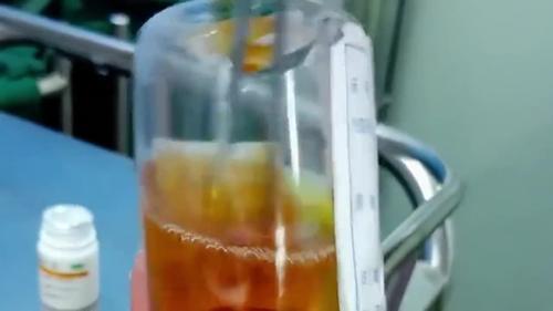 碘伏遇上VC的实验,经过护士的搅拌变成白色,知道是什么原理吗