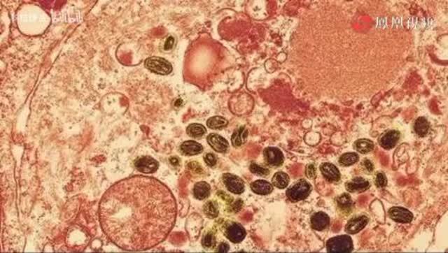 世界上10大最致命的病毒,肯定有你不知道的