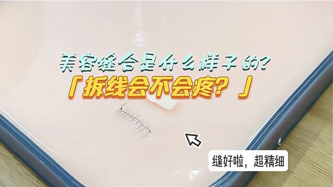 美容缝合是什么样子的?拆线会不会疼?