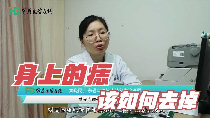 身上的痣,该如何去掉?激光点痣是最好的方法吗?