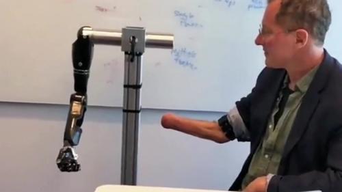 办法都是人想出来的,残疾人有了这款机械臂,这灵活程度不次于真手臂!