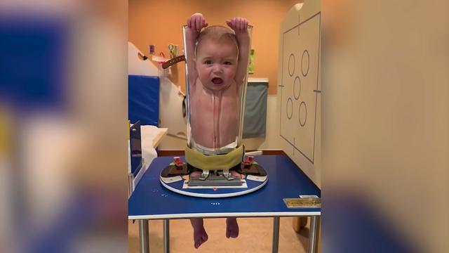 婴儿是如何做X光检查的?把婴儿抱进透明圆桶里,防止乱动 #X光检查 #...