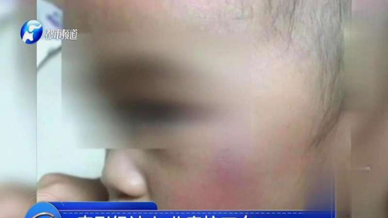 安全牵引绳,孩子不怕丢?遛娃神器成坑娃凶器,多地发生被夹事件