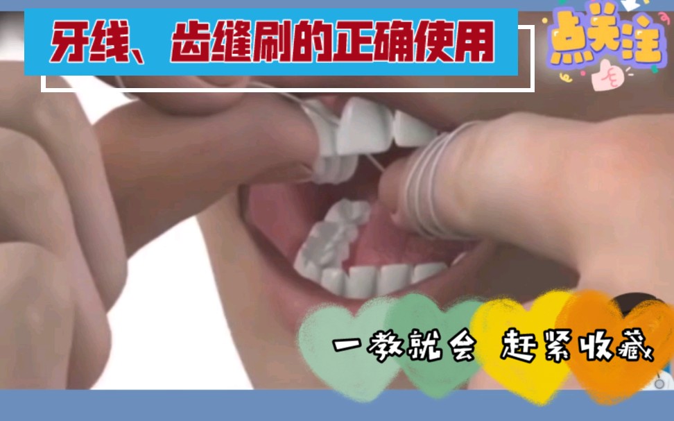 【牙线、齿缝刷】你学会了?宝藏教程,一教就会,赶紧收藏!