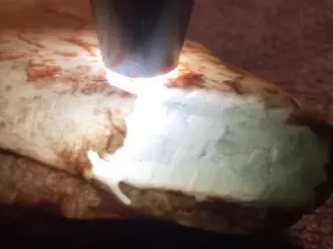 这种皮壳的翡翠原石你们想要吗, 还在犹豫吗? 红皮木那翡翠赌石