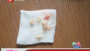 女孩鼻腔发臭 原是填塞异物