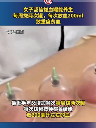 女子坚信拔血罐能养生,每周拔两次罐,每次放血200ml致重度贫血