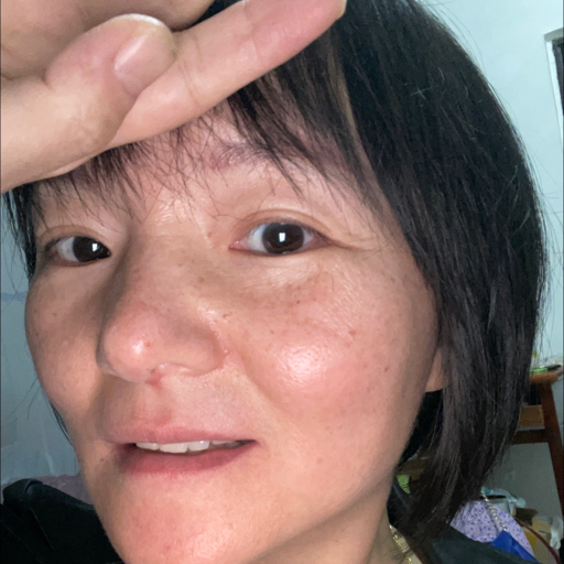 阿周已醒 