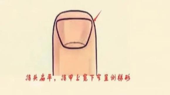 中指形状:指头扁平,指甲上宽下窄呈倒梯形