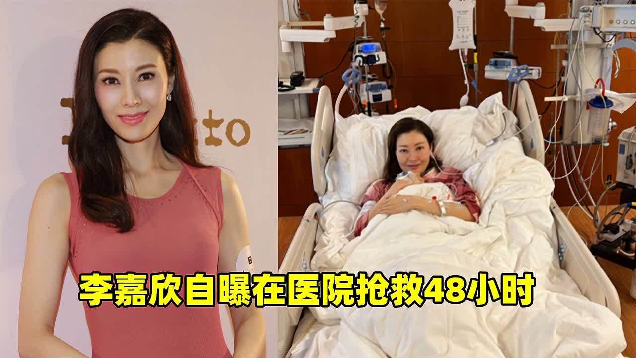 51岁李嘉欣病危住进ICU,抢救48小时捡回性命,住院插管画面曝光