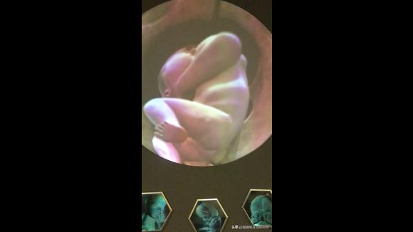 科普:小宝宝的生命是如何诞生的。