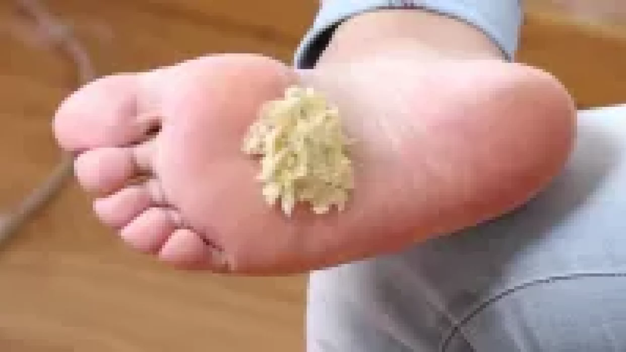 睡前把生姜敷在脚底太厉害了,不少朋友不明白有啥用,快看看