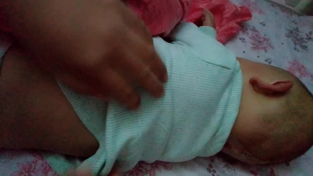 小儿推拿视频捏脊推拿手法