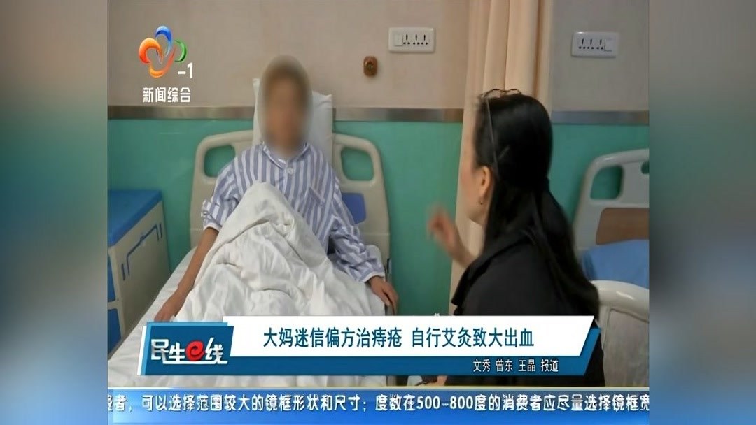 大妈迷信偏方治痔疮 自行艾灸致大出血