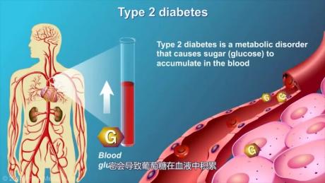 介绍2型糖尿病的发病因素、临床表现和胰岛素的作用机制