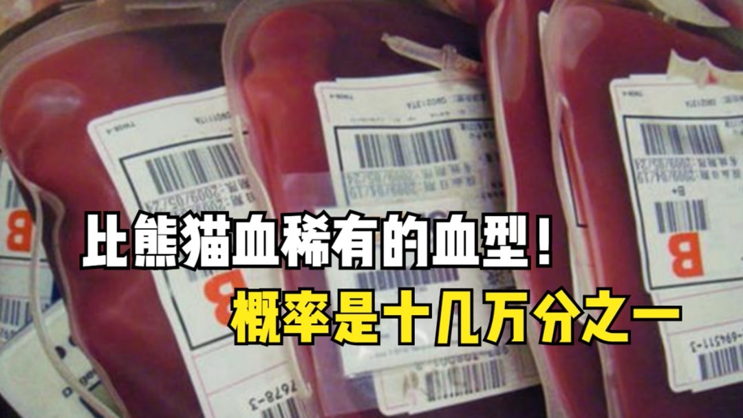 比熊猫血稀有的血型!概率是十几万分之一,中国发现不到30例!