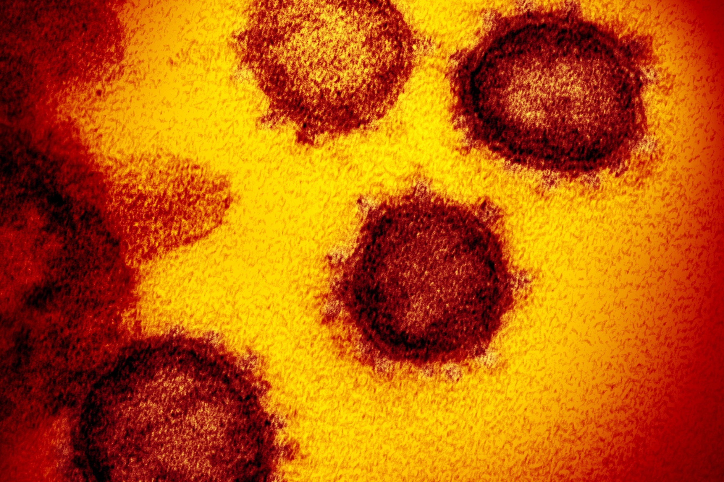 新冠病毒“高清彩照”曝光