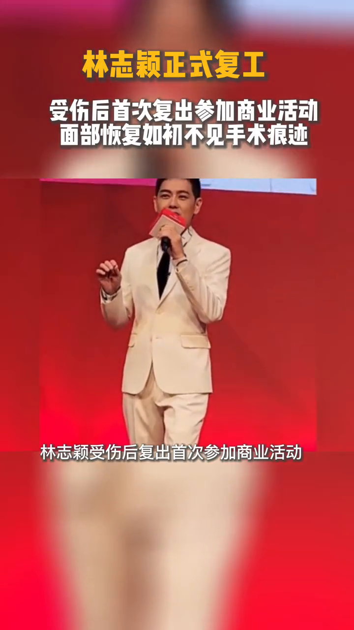 林志颖复工,面部恢复如初不见手术痕迹!