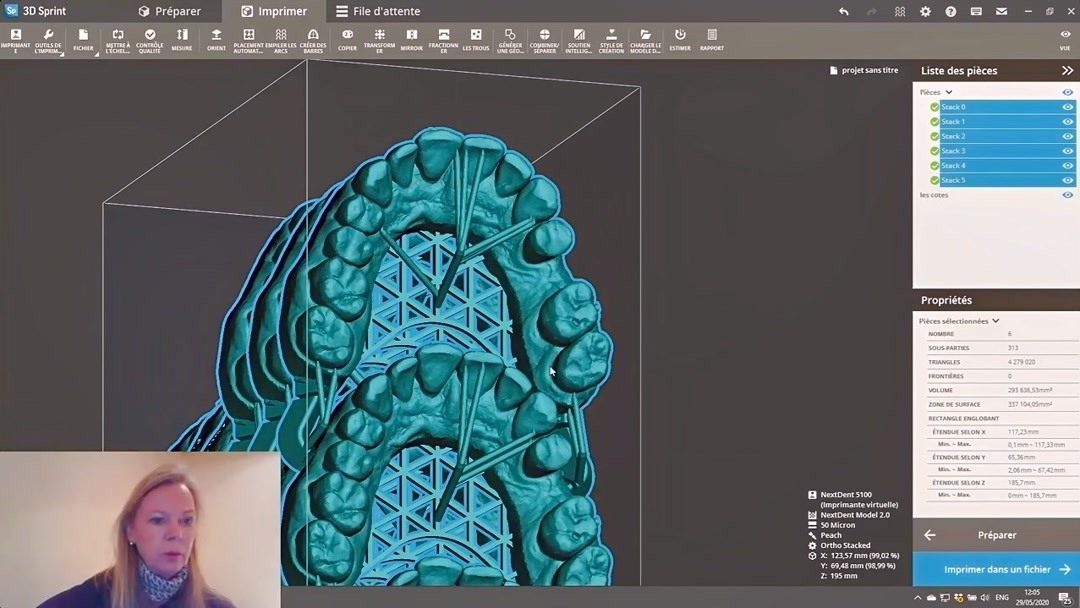 NextDent 5100 如何3D打印垂直堆叠的正畸模型