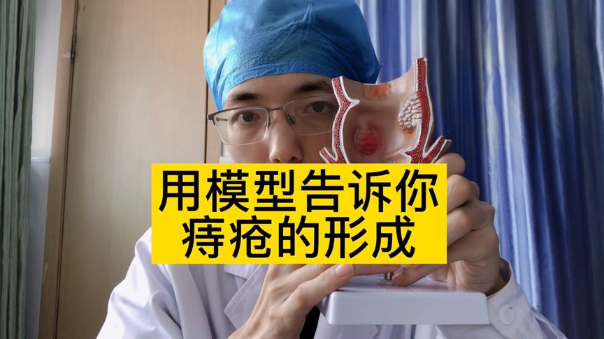 用这个模型告诉你,痔疮是怎么形成的!