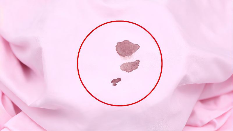 床单上有干血渍不用愁了，教你简单方法，新旧血渍轻松去除，真棒