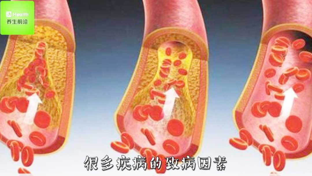 血管老了又硬又脆弱,一伸一拉全身血管做运动,远离瘀堵破裂