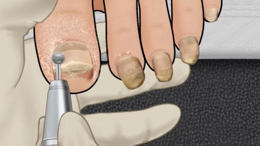 超解压修脚过程(中),沉浸式动画,看完太舒服了