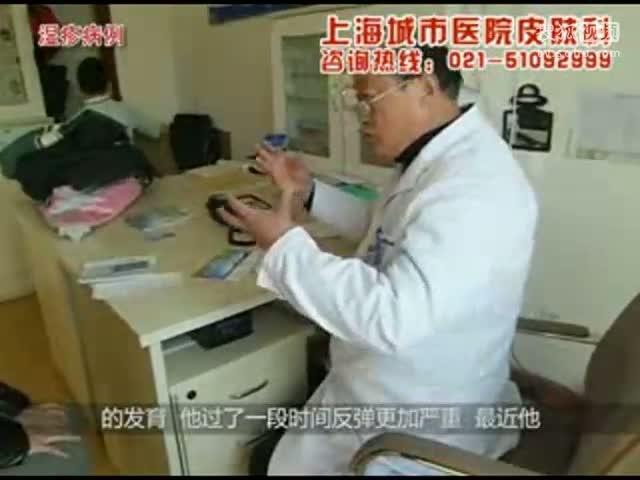 过敏性皮炎湿疹在线专家咨询-上海城市医院皮肤科