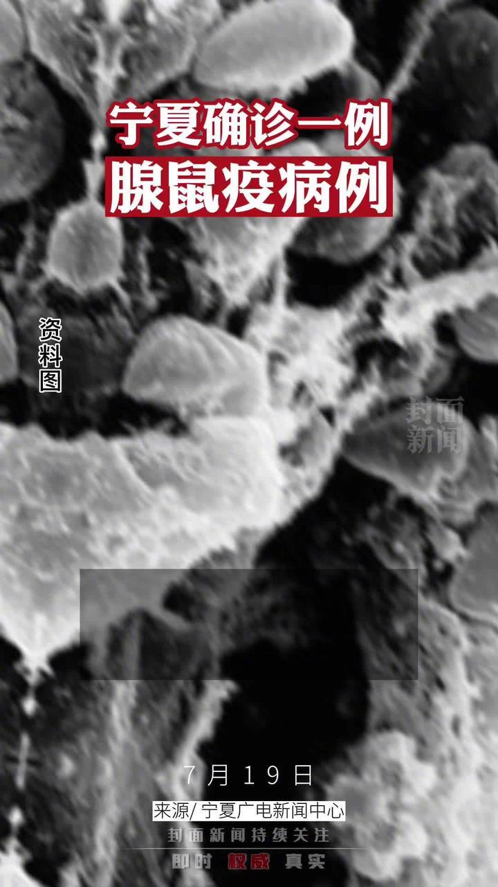 ...2022年7月19日,我区确诊一例区外输入性原发性鼠疫(腺鼠疫)病例。...