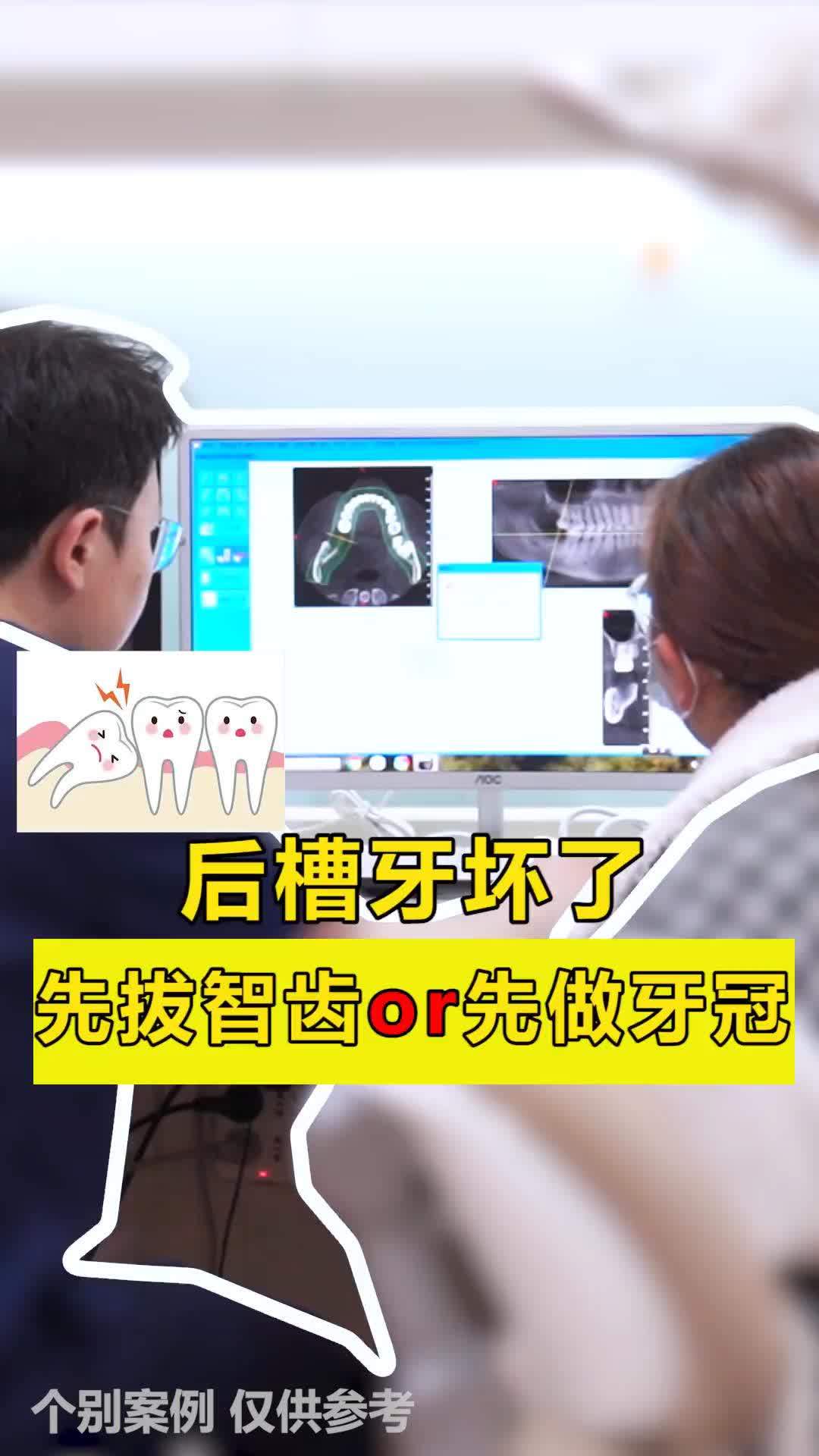 (智齿前面的那颗)7号后槽牙如果做根管治疗戴牙冠,建议先下期...