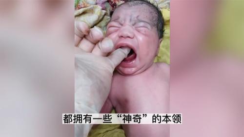 刚出生的小宝宝张开嘴,医生立马把手塞进入,紧接着太逗了