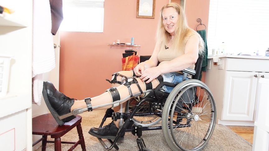 女子患怪病,极想成为残疾人!这使她不断自残甚至要截肢