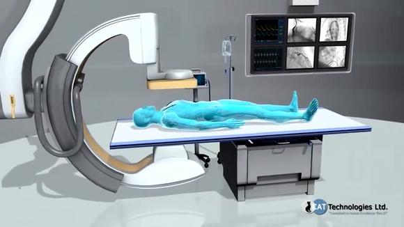 冠状动脉造影3D模拟全过程!