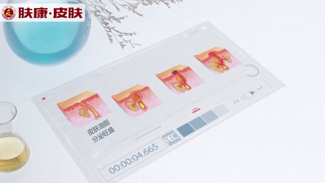 痘痘该如何治疗?东莞肤康皮肤科靠谱吗?