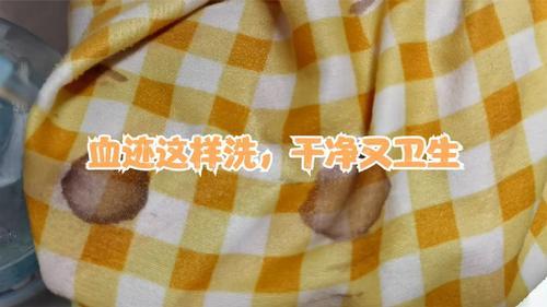 床单有干血迹不需要愁,教你个好方法。多久的血渍都能轻松去除