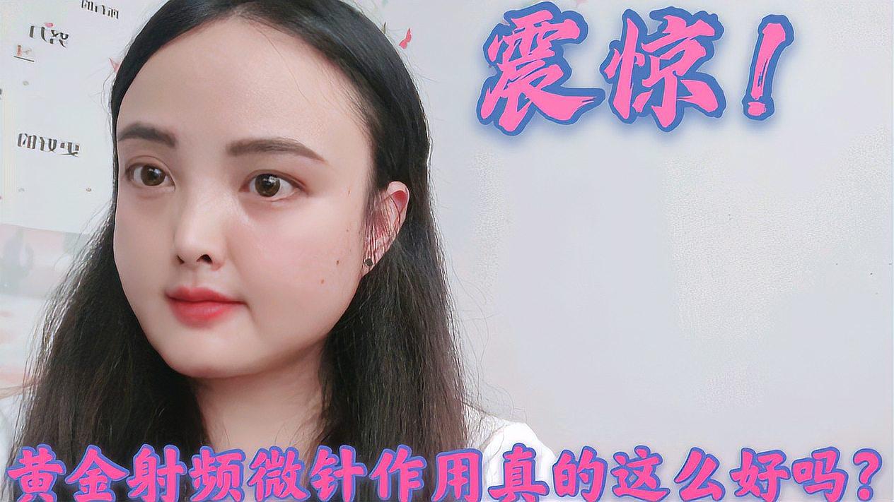 黄金射频微针作用真的这么好吗