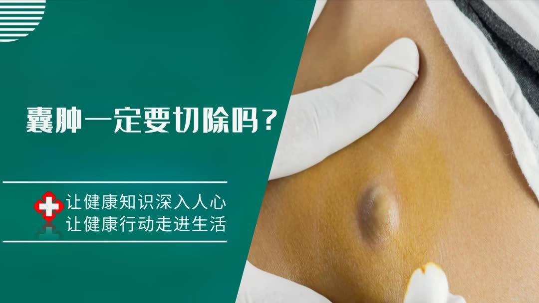 囊肿一定要切除吗?提醒:面对这几种,别犹豫越早切除越好