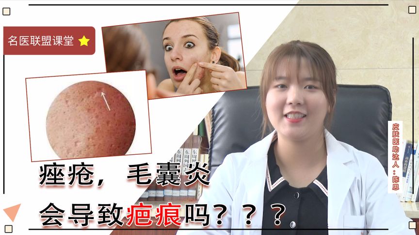 痤疮会导致疤痕吗?千万别去这种机构!不良清痘行为可导致疤痕。