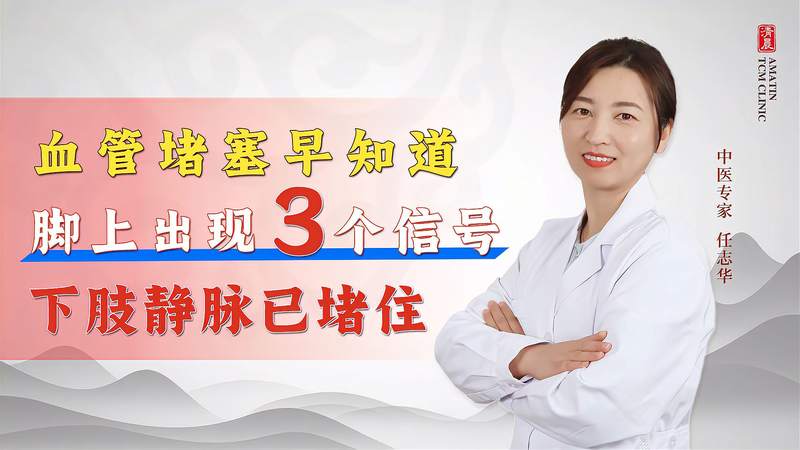 血管堵塞早知道 脚上出现3个信号 下肢静脉已堵住